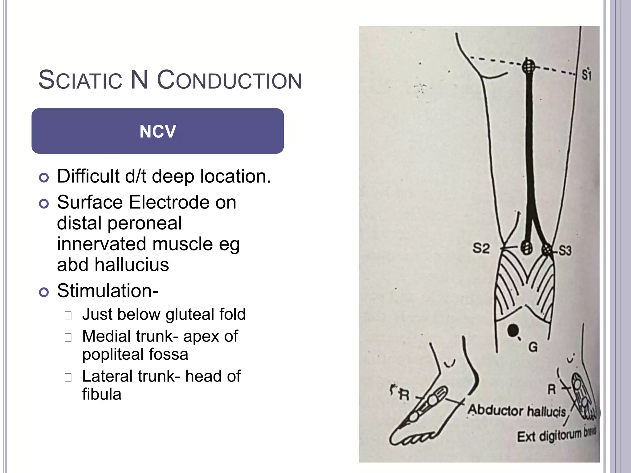 Nerve Conduction Studies- Lower Leg | PPTX