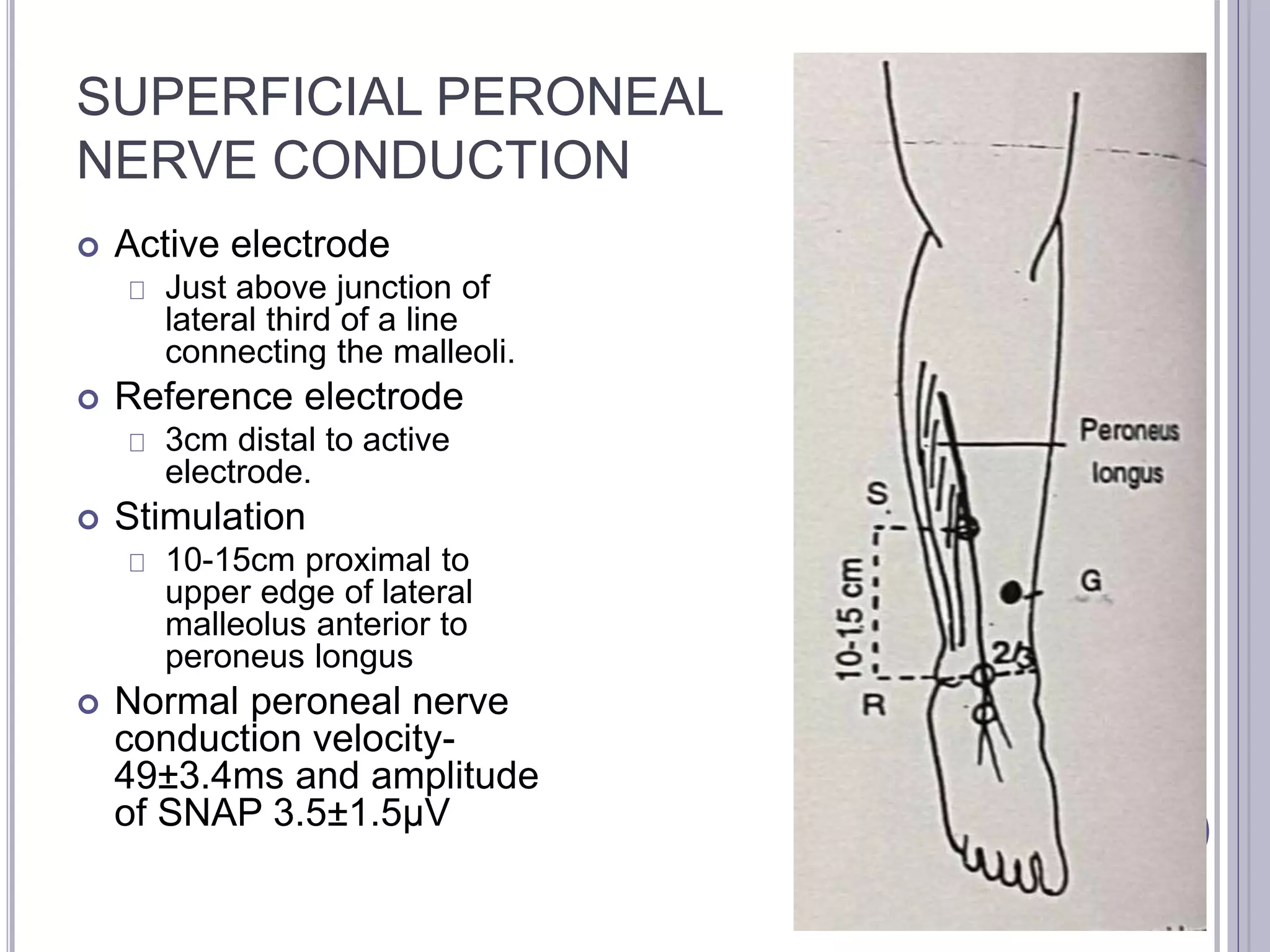 Nerve Conduction Studies- Lower Leg | PPTX