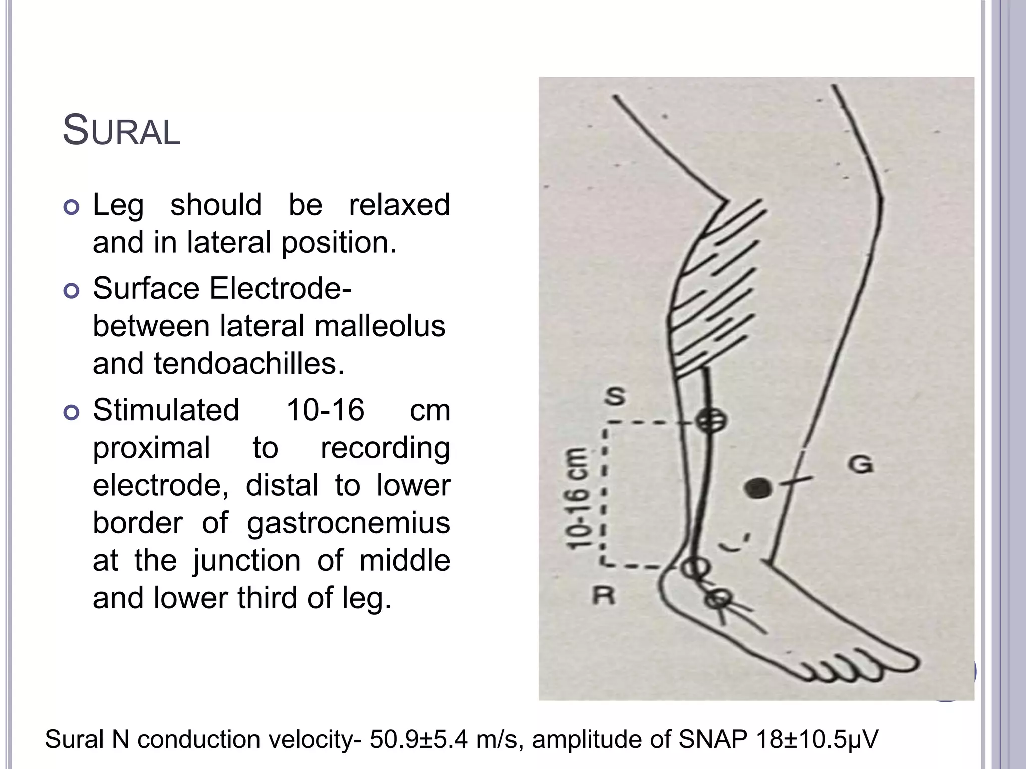 Nerve Conduction Studies- Lower Leg | PPTX