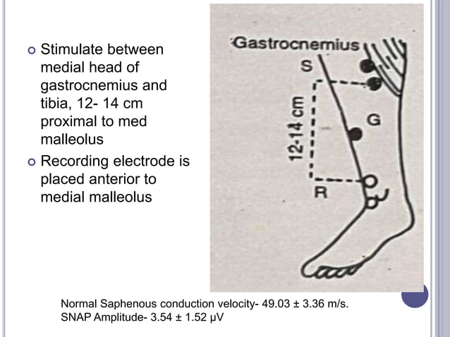 Nerve Conduction Studies- Lower Leg | PPTX