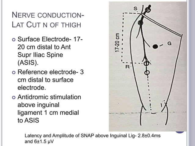 Nerve Conduction Studies- Lower Leg | PPTX