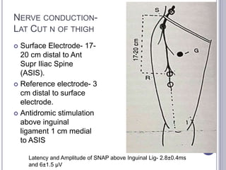Distal Lesion Of The Lateral Femoral Cutaneous Nerve, 50% OFF