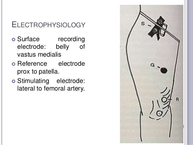 Nerve Conduction Studies- Lower Leg