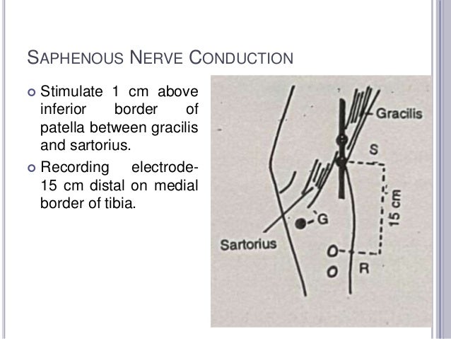 Nerve Conduction Studies- Lower Leg