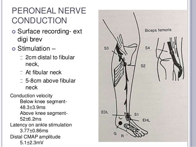 Nerve Conduction Studies- Lower Leg