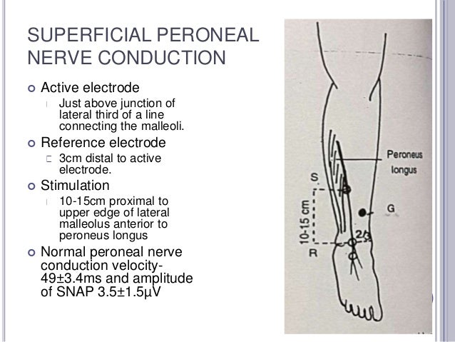 Nerve Conduction Studies- Lower Leg