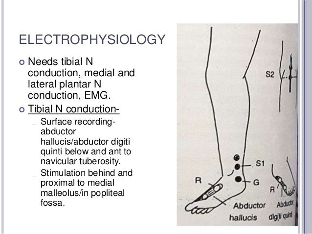 Nerve Conduction Studies- Lower Leg
