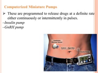 Novel drug delivery system | PPT