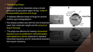 Ocular drug delivery system | PPT