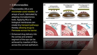 Ocular drug delivery system | PPT