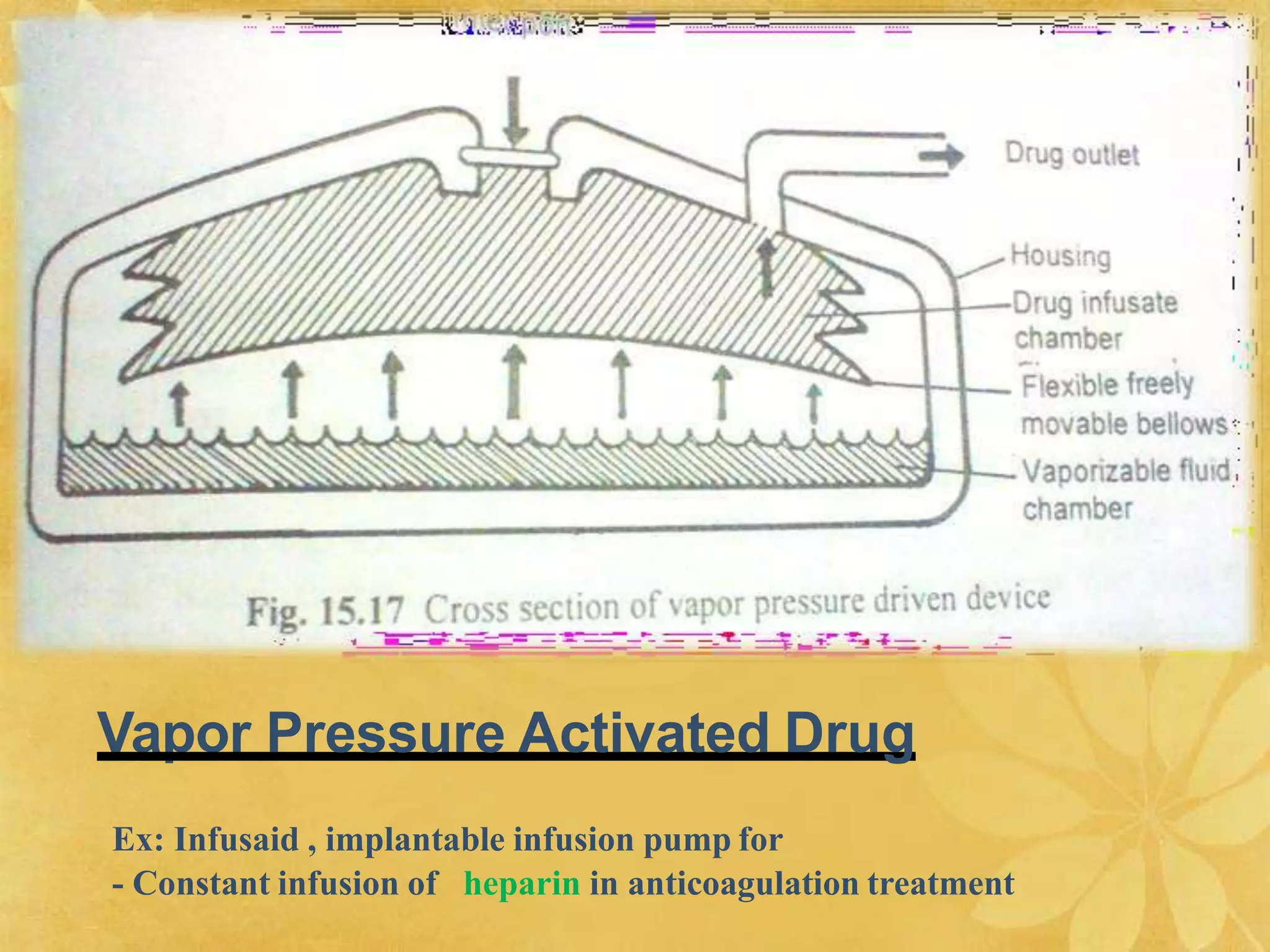 Ndds 6 Implantable Drug Delivery System | PPTX