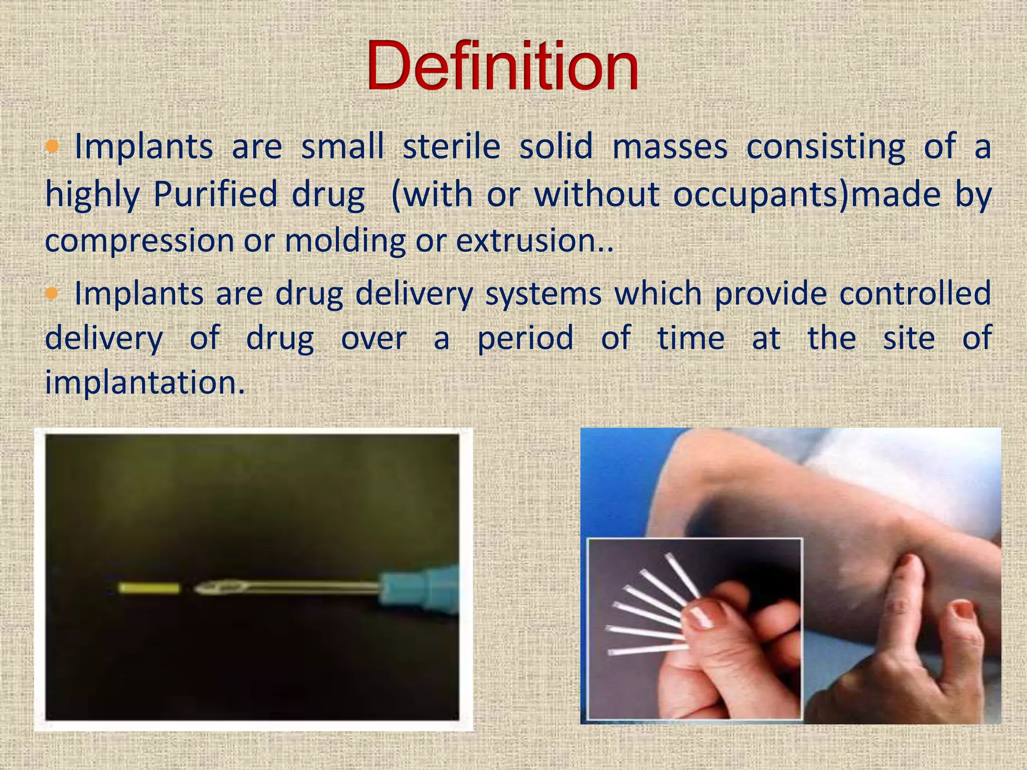 Ndds 6 Implantable Drug Delivery System | PPTX