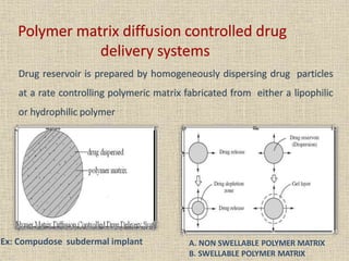 Ndds 6 Implantable Drug Delivery System | PPTX
