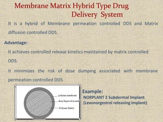 Ndds 6 Implantable Drug Delivery System | PPTX