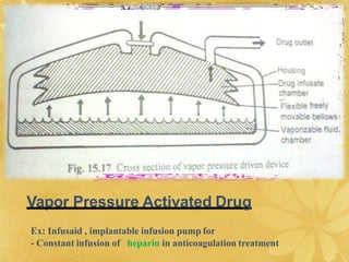 Ndds 6 Implantable Drug Delivery System | PPTX
