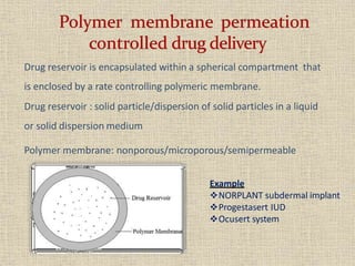 Ndds 6 Implantable Drug Delivery System | PPTX