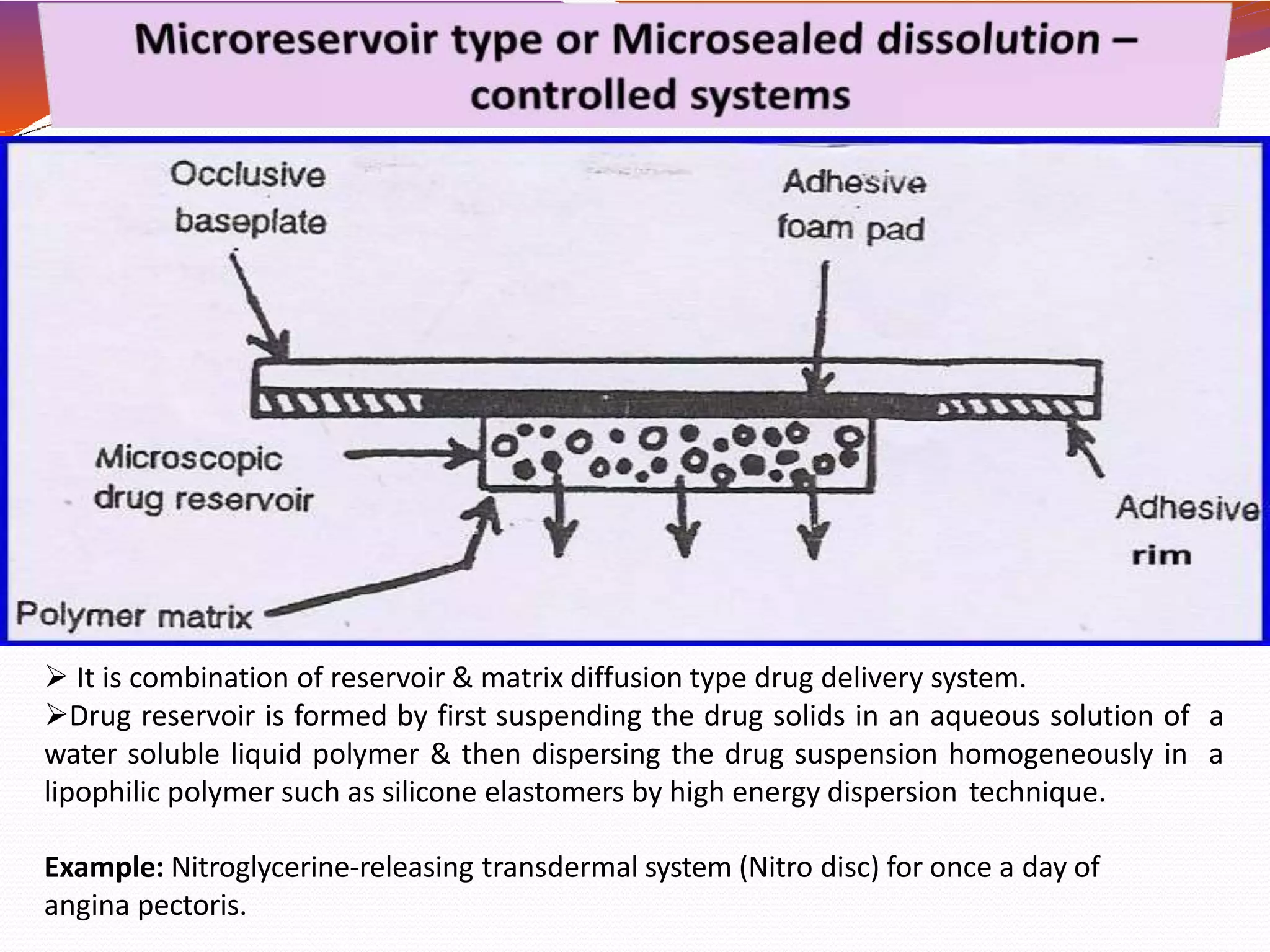 Ndds 7 Transdermal Drug Delivery System Ppt