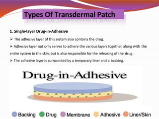 Ndds 7 Transdermal Drug Delivery System | PPTX