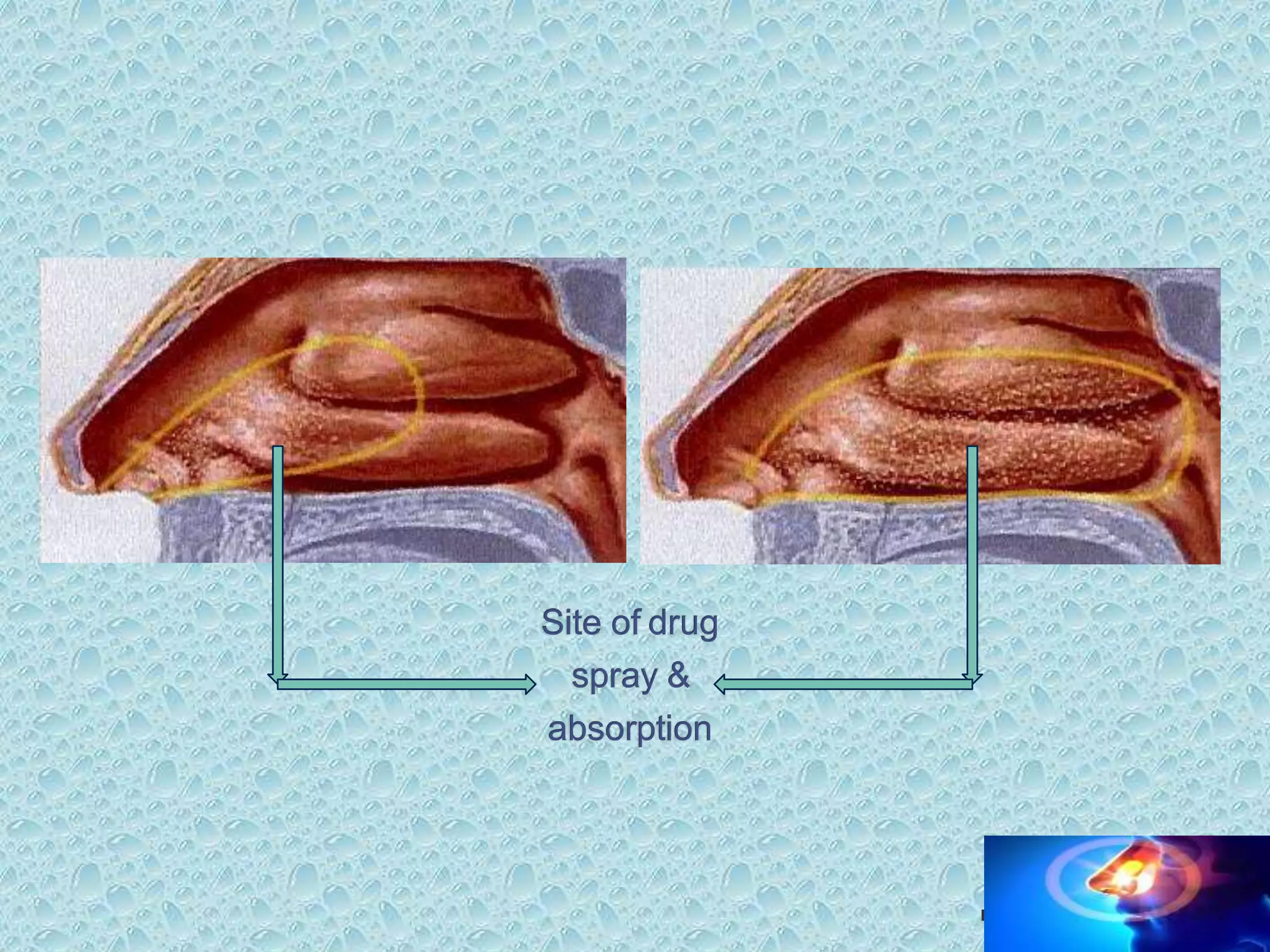 Ndds 9 Nasal Drug Delivery System | PPTX