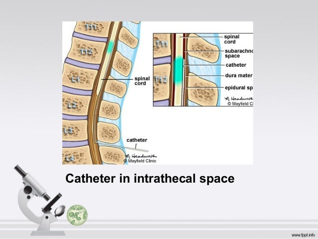 Intrathecal Space