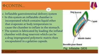Gatro retentive drug delivery system | PPTX