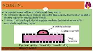 Gatro retentive drug delivery system | PPTX