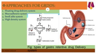 Gatro retentive drug delivery system | PPTX