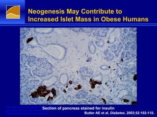 Ndei Beta Cell Slide Kit Biology | PPT | Endocrine and Metabolic ...