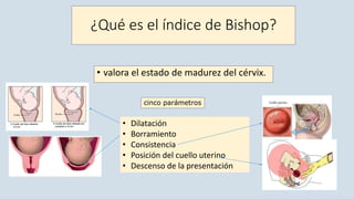 Índice de BISHOP.pptx