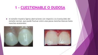 Indice de Dean. Fluorosis dental | PPTX