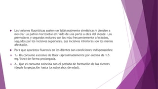 Indice de Dean. Fluorosis dental | PPTX
