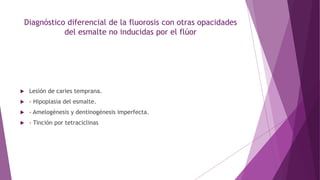 Indice de Dean. Fluorosis dental | PPTX