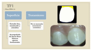 Indices de deán, índices de fluorosis por superficie dentales | PPTX