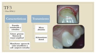 Indices de deán, índices de fluorosis por superficie dentales | PPTX