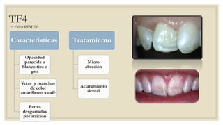 Indices de deán, índices de fluorosis por superficie dentales | PPTX