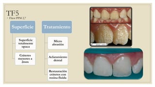 Indices de deán, índices de fluorosis por superficie dentales | PPTX