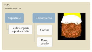 Indices de deán, índices de fluorosis por superficie dentales | PPTX
