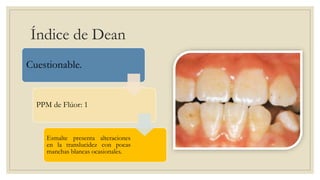 Indices de deán, índices de fluorosis por superficie dentales | PPTX