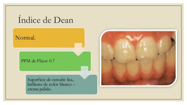 Indices de deán, índices de fluorosis por superficie dentales