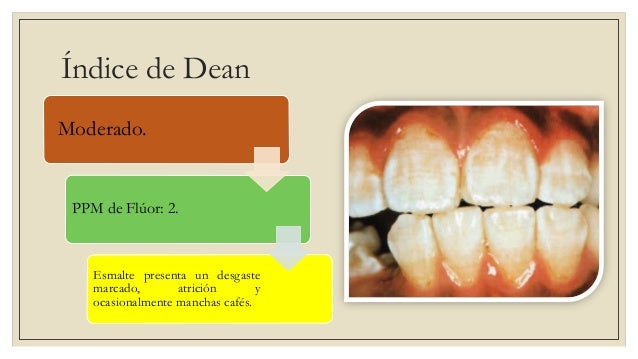 Indices de deán, índices de fluorosis por superficie dentales