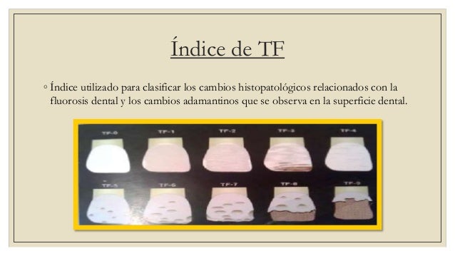 Indices de deán, índices de fluorosis por superficie dentales