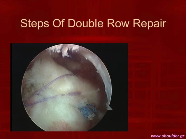Double row athlitiatriko 2008 | PPT