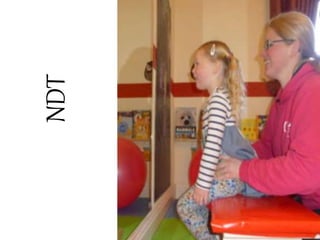 Neurodevelopemental Therapy (Bobath approach)- Principles and Evidence ...