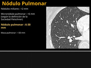 Nódulo Pulmonar en Tomografía - Aspectos Principales.pptx