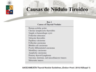 Nódulo tiroideo | PDF
