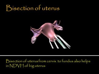 Ndvh trips and tricks | PPT