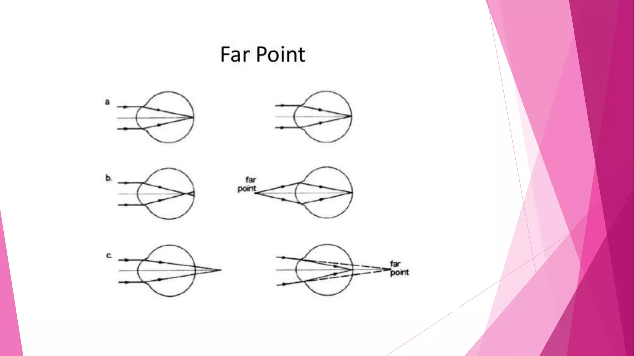 Near point and far point of accommodation | PPTX