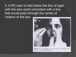 Near point of convergence | PPTX