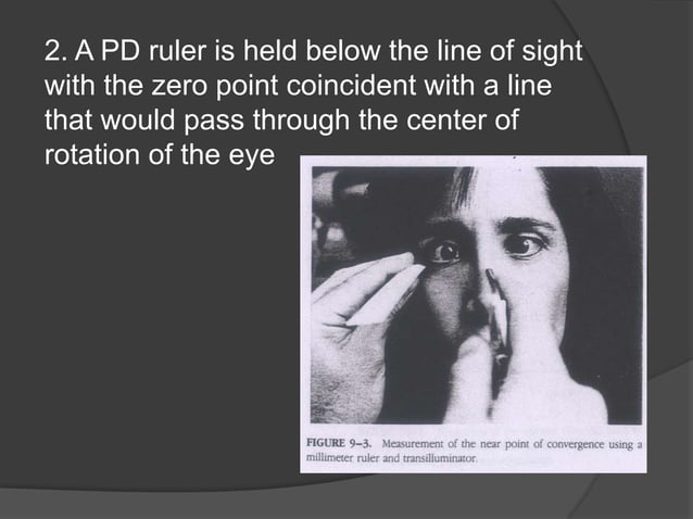Near point of convergence | PPTX | Eye and Vision Conditions | Diseases ...