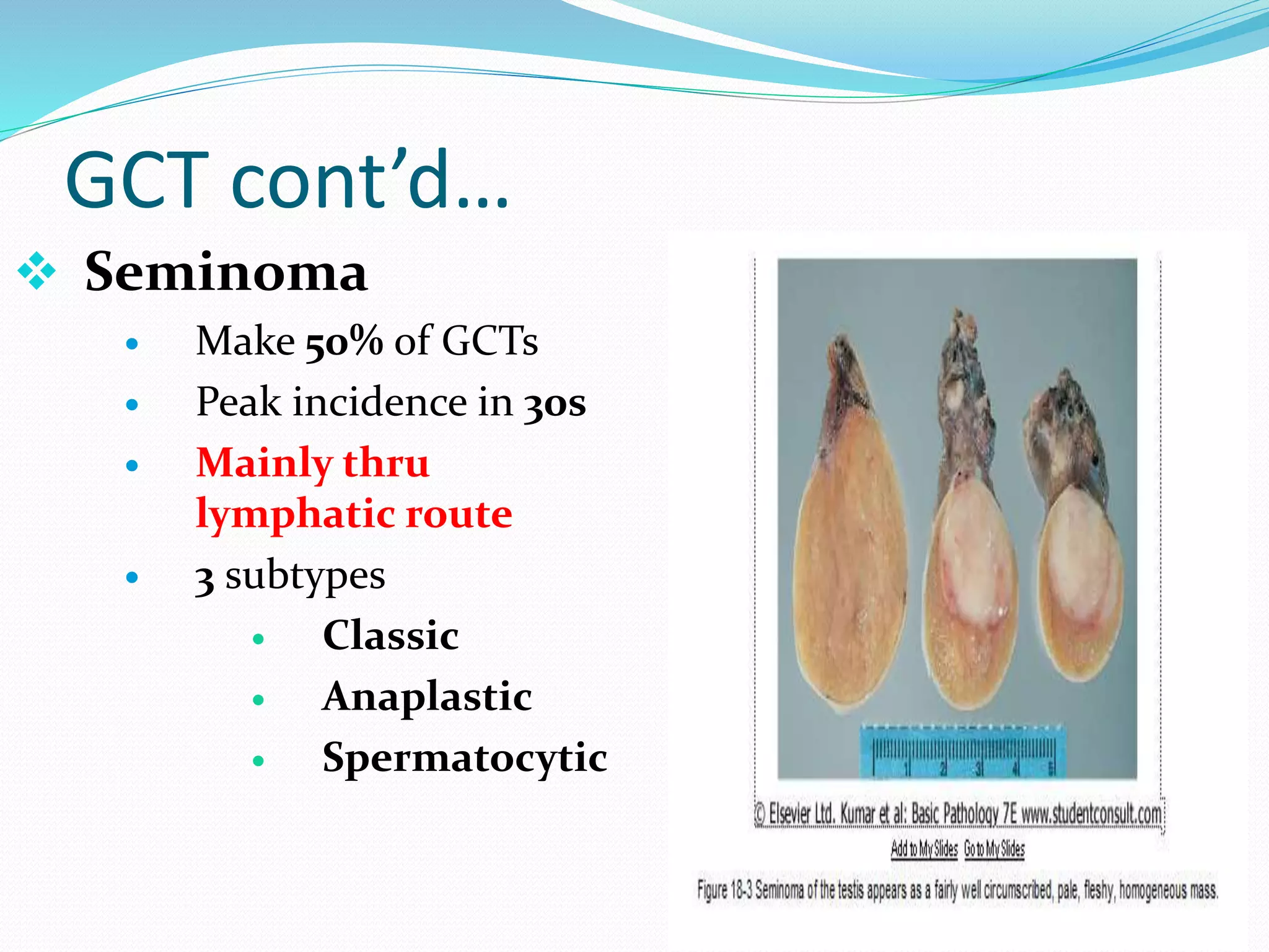 Pathology of testicular tumors | PPTX